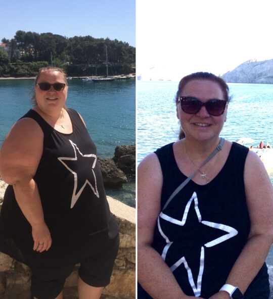 Adipositas permagna: Definition, Ursachen und Behandlung | Oviva